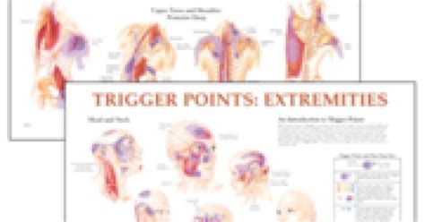 Trigger Points Chart Set