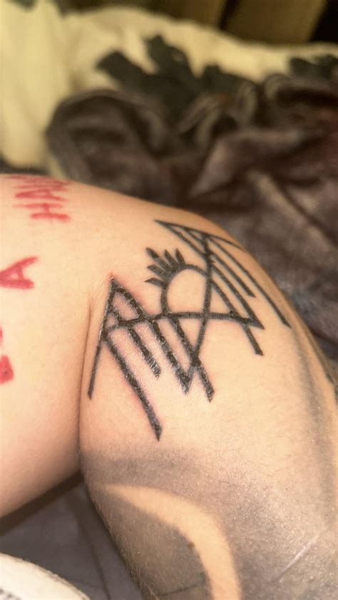 Help Is This Tattoo Infected Or Just Overworked Rtattooadvice