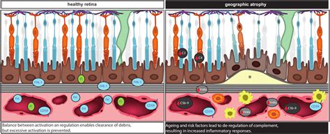 Complement Regulation In The Retina In The Healthy Retina Presence Of