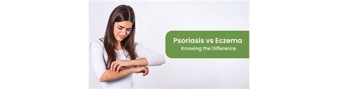 Psoriasis Vs Eczema Understanding The Differences