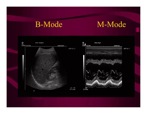 Physical Principles Of Ultrasound Pdf