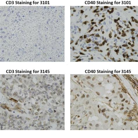 Human Melanoma Tissue Sections Were Stained For Cd3 And Cd40 A Tissue