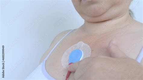 Electronic Sensor On Female Chest For Holter Monitoring Track