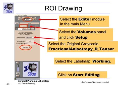 Diffusion Tensor Imaging Analysis 3749