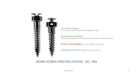 Infra Zygomatic Crest Implants Izc Pptx