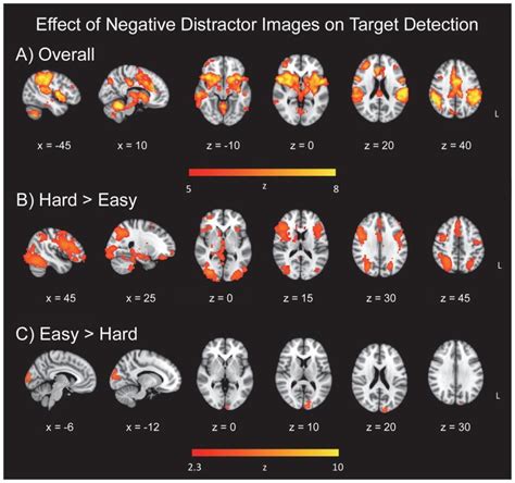 Task Difficulty Modulates Brain Activation In The Emotional Oddball