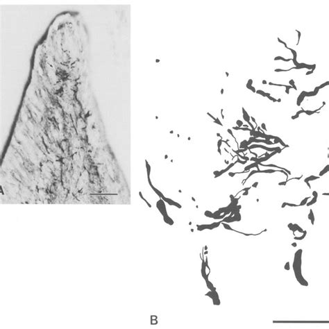 A Camera Lucida Drawing A And Photomicrograph B Of Parvalbumin Ir