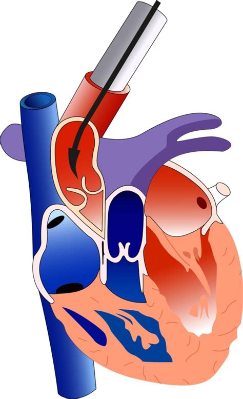 Isolated Heart Perfusion System Mappinglab