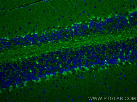 S100b Antibody 15146 1 Ap Proteintech