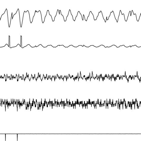Original Eeg Signals Download Scientific Diagram Original Eeg Signals Download Scientific Diagram