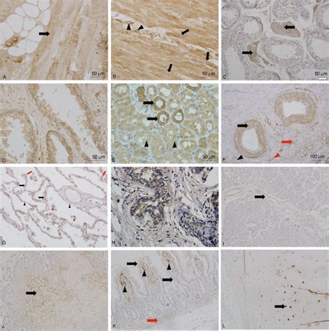 Kindlin 2 Expression At Various Levels In Human Adult Normal Organs A Download Scientific