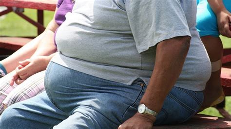 La Obesidad Una Epidemia Del Siglo Xxi