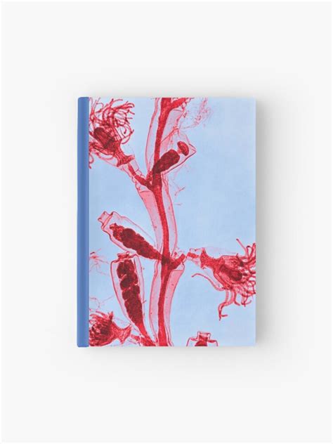 Obelia Biology Journal Polymorphism In Coelenterata Types And