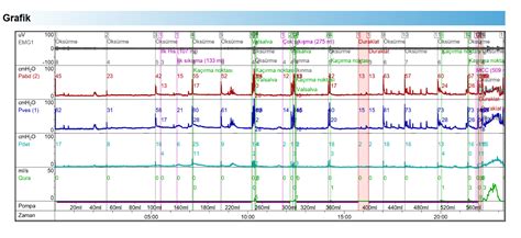 Uds Study In Patients