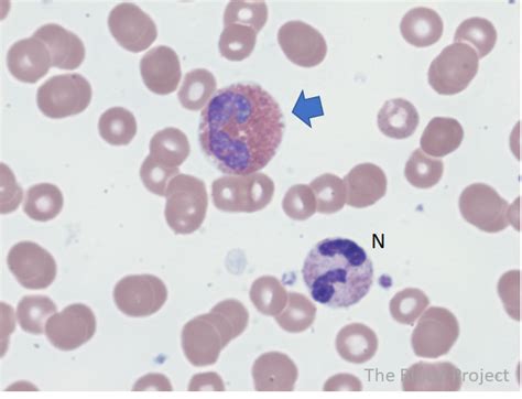 Eosinophil Under Microscope