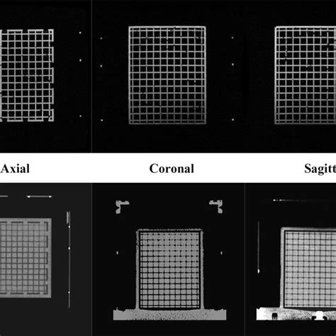 Orthogonal 3 Plane Mri Top And Corresponding Ct Images Bottom Of Download Scientific