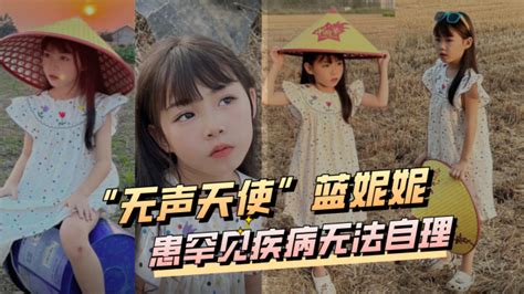 无声天使”蓝妮妮，患罕见疾病无法自理，其父做法令人不解腾讯新闻