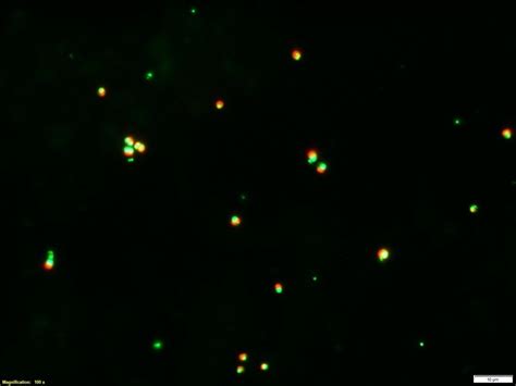 Strain Improvements Keep Algae Ponds Growing Strong Department Of Energy