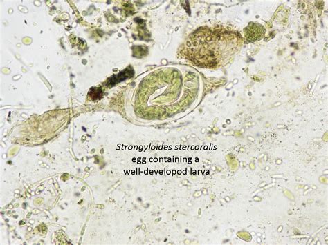 Creepy Dreadful Wonderful Parasites Answer To Case 469