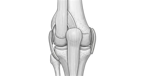 Tibial Tuberosity Bump In Adults