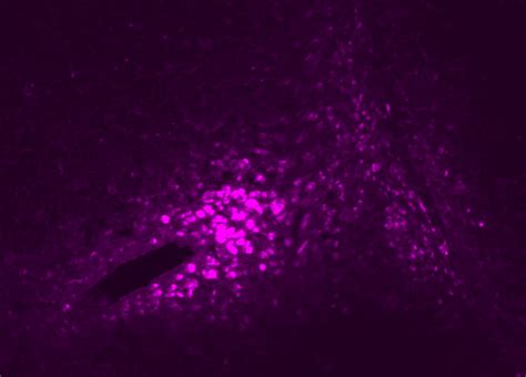 Confirmation Of Dreadd Suspicious Cells Researchgate