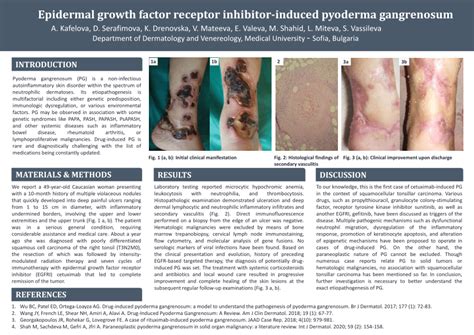 Pdf Epidermal Growth Factor Receptor Inhibitor Induced Pyoderma