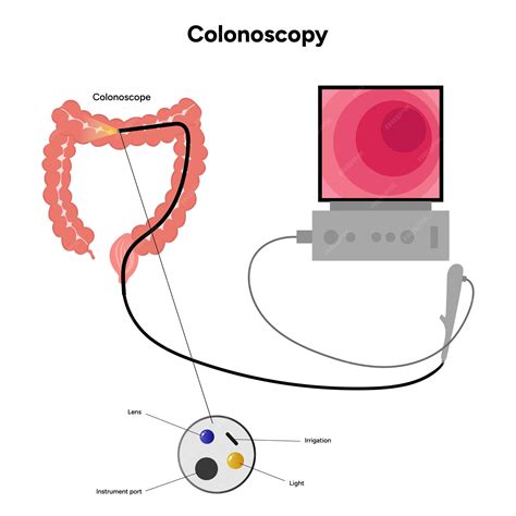 Premium Vector Colonoscopy And Colonoscope
