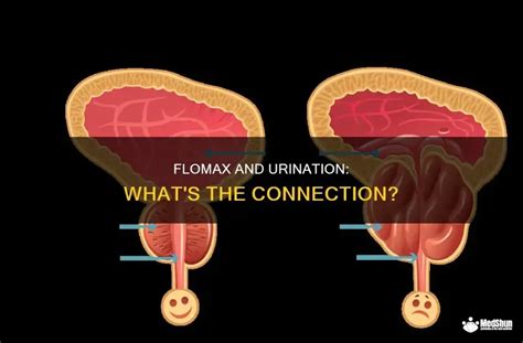 Flomax And Urination Whats The Connection Medshun