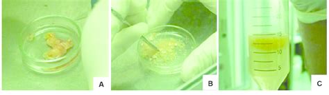 The Process Of Receiving And Processing Fat Tissue A Adipose Tissue