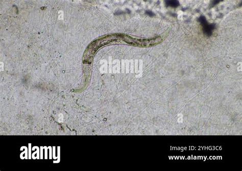 Nematodes Soil Stock Videos And Footage Hd And 4k Video Clips Alamy