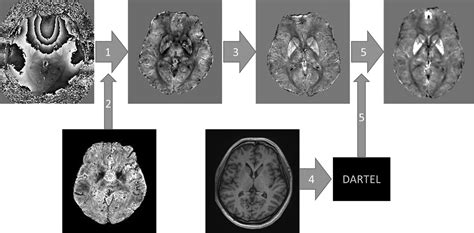 Quantitative Susceptibility Mapping At 3 T And 15 T Evalua