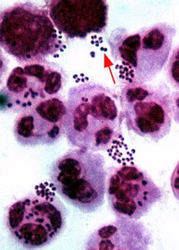 2 Bacterial Classification Mycoplasma And Mycobacteria Flashcards Quizlet