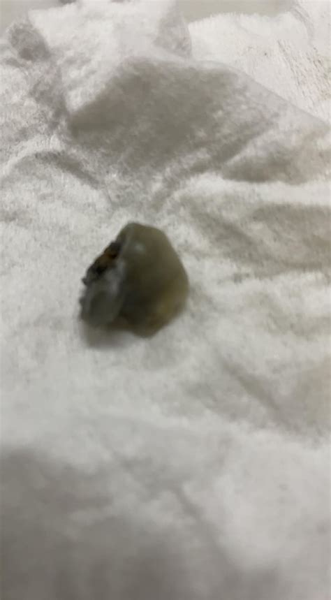 Found Tooth Inside Home Rinlandempire