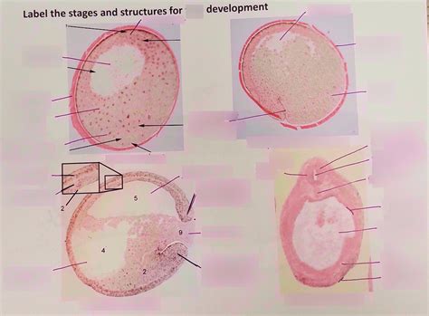 Embryology Pg 3 Diagram Quizlet