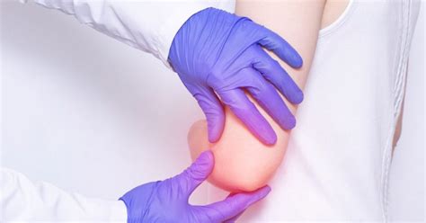 On The Spot First Aid Techniques For Managing Dislocated Joints The First Aid Nest