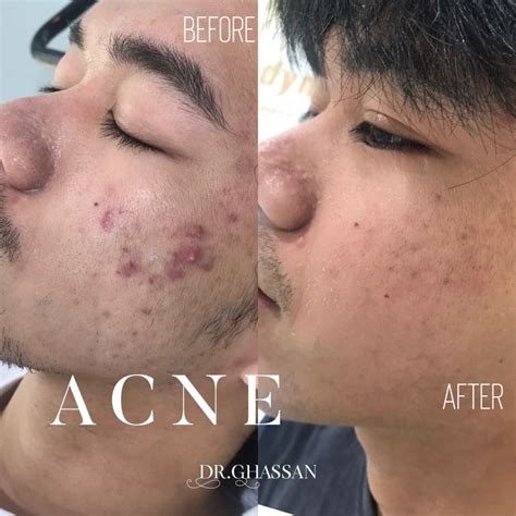 Ghassan Salameh Posted On Linkedin