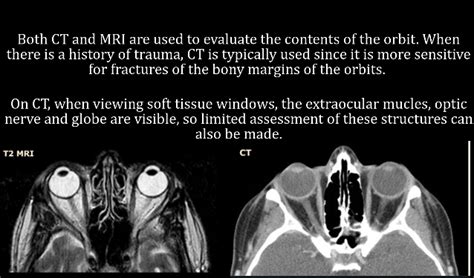 Ct Vs Mri Ct Scan And Mri