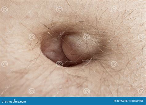 Lump In Belly Button Hernia An Inflammatory Condition Possible