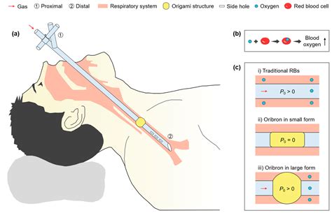 Rigid Bronchoscopy