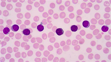 Entendamos Los Linfocitos Y Su Impacto En La Salud