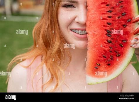 Beautiful Red Haired Woman Smiling With Braces On Her Teeth Covers Half Of Her Face With A Slice