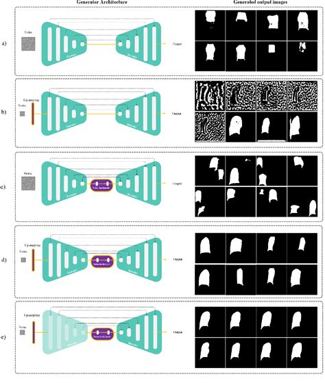 Dynamic Pix2pix Noise Injected Cgan For Modeling Input And Target