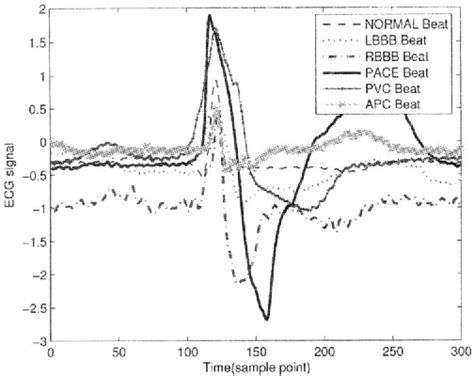 Feature Extraction For Classification Fasrcatering