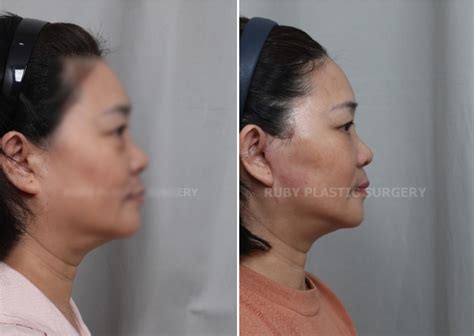 Welcome To Ruby Plastic Surgery