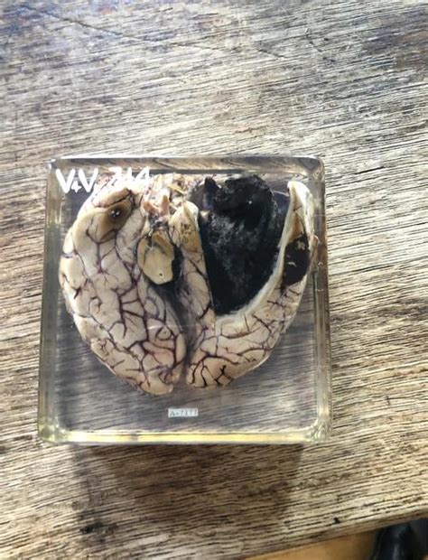 The Mutter Museum Philly Unveiling Medical Marvels And Macabre History