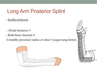 Splints And Tractions Pptx