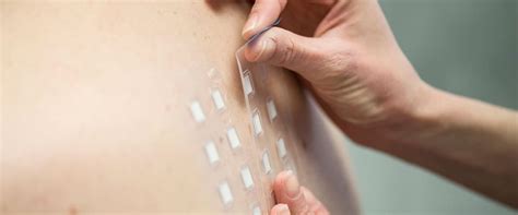 Contact Dermatitis Patch Testing Massachusetts Dermatology Associates