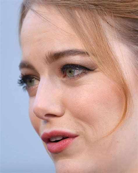 Emma Stone Teeth Spiderman