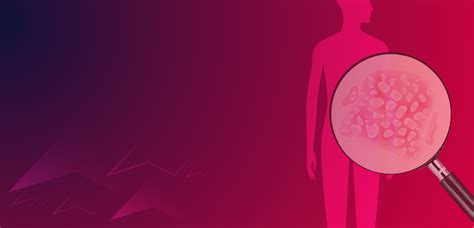 Pelages Pp405 Demonstrates Efficacy In Phase 2a Trial For Androgenetic Alopecia Dermatology