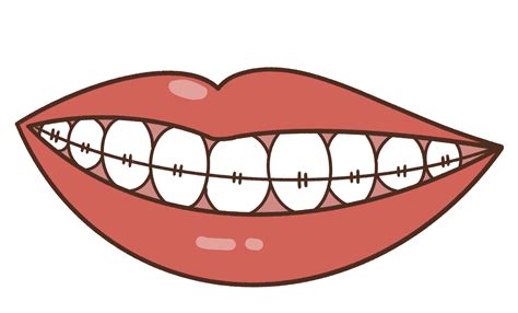 Dentist Braces Teeth 25106851 Png